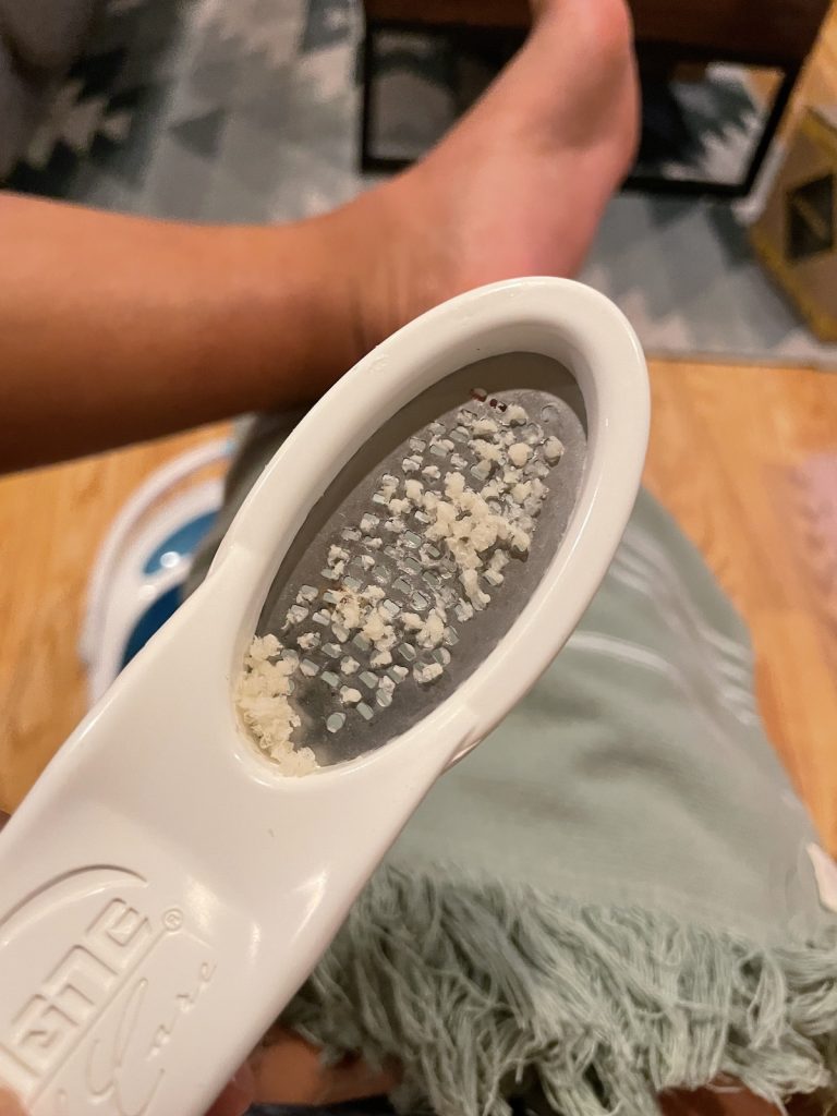 How to Soften Extremely Dry Feet - Schimiggy Reviews
